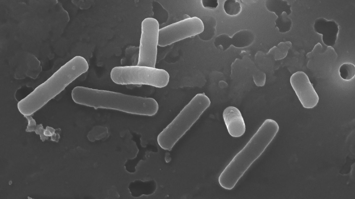 Lactobacillus Manipulates Bile Acids to Create Favorable Gut ...